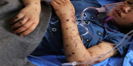 „Ich will meine Beine zurück“: Amputierte Kinder in Gaza